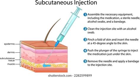 Subcutaneous Injection Explanation Illustration Stock Vector Royalty