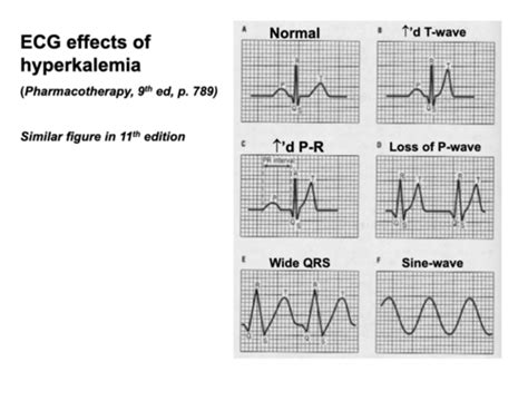 Hyperkalemia Acid Base Dehydration Flashcards Quizlet