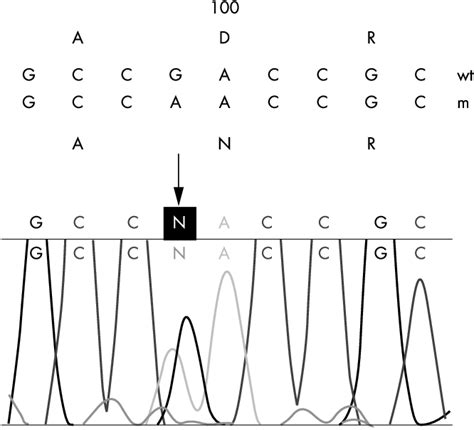 Chromatogram Of The Mutated Sequence Both The Nucleotide And The Amino