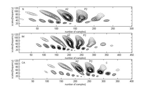 Continuous Wavelet Transform Cwt For The Second Sound S2 Of The