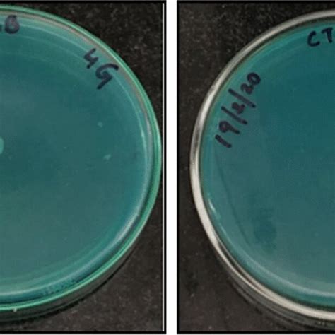 Anionic Surfactant Was Determined Using Ctab Assay From Virgibacillus Download Scientific