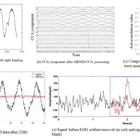 Artifacts Removal A Original Signal Of Motion Execution With Right Download Scientific