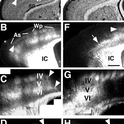 A Regional Shift In The Cortical Plate Alone Leads To Skewed Download Scientific Diagram