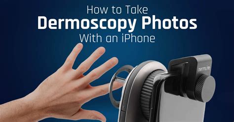 How To Take Dermoscopy Photos With An Iphone