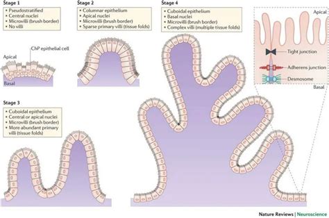 Pictures Of Choroid Plexus