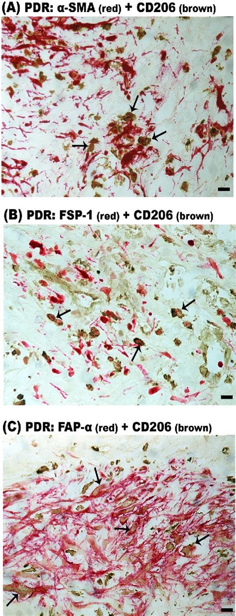 Figure 8 From Macrophage Myofibroblast Transition Contributes To Myofibroblast Formation In