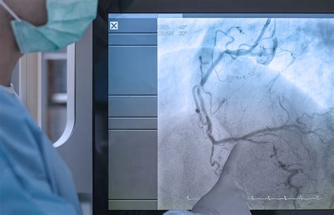 Cardiac Catheterization Lab Cumberland Medical Center
