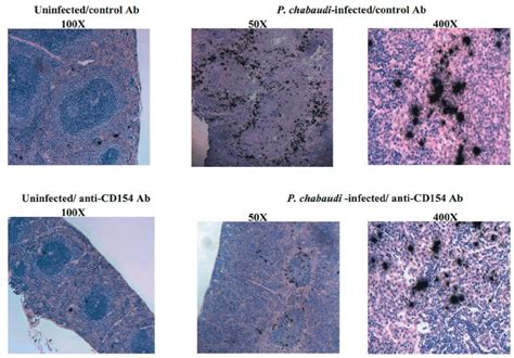 Localization Of Hiv 1 Mrna Expression By In Situ Hybridization In Download Scientific Diagram