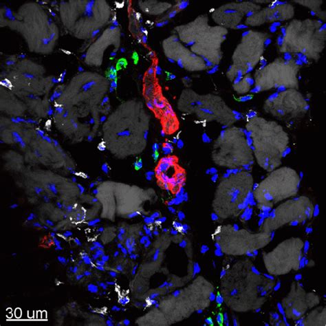 Histological Evaluation Of The Ivm Results And Visualization Of Either