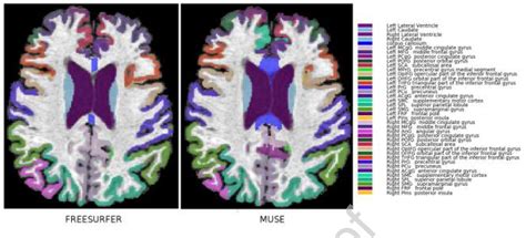 Figure 1 From A Comparison Of Freesurfer And Multi Atlas Muse For Brain