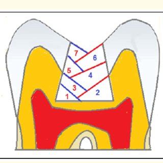 Successive Cusp Build Up Technique Download Scientific Diagram