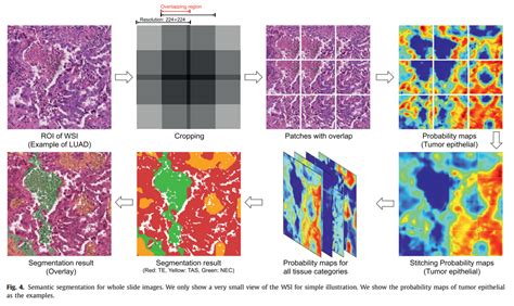 Multi Layer Pseudo Supervision For Histopathology Tissue Semantic