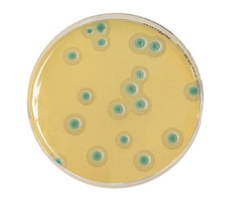 Detection Bacillus Cereus Biokar Diagnostics