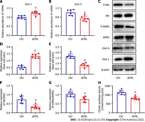 Dietary Nε Carboxymethyl Lysine Affects Cardiac Glucose Metabolism