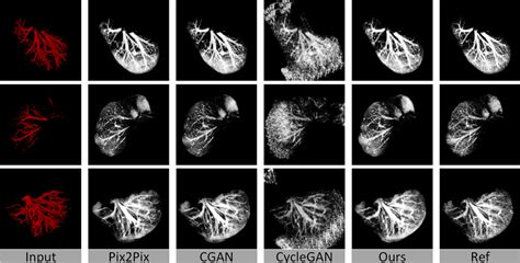 The Visualization Of The 3d Ct Synthesis Image Download Scientific