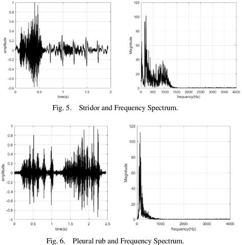 figure 5 from comparison of multilevel wavelet packet entropy using