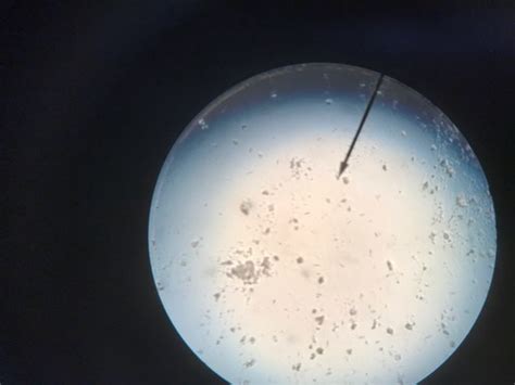 Lab Practical Microscope Slides Flashcards Quizlet