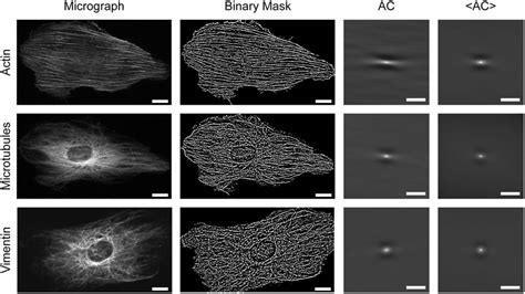A Two Step Algorithm Consisting Of Image Segmentation And Download