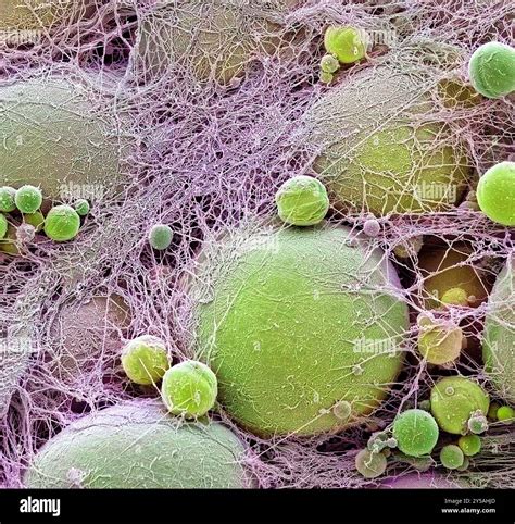 Fat Cells Coloured Scanning Electron Micrograph Sem Of Joined Fat Storing Cells Adipocytes