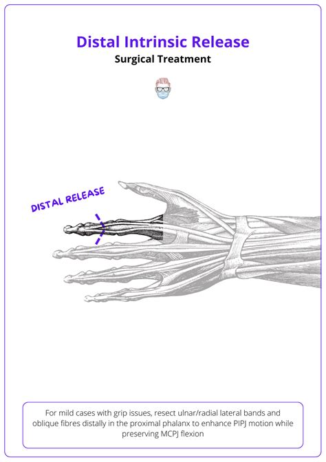 Intrinsic Plus Hand Anatomy Aetiology And Management