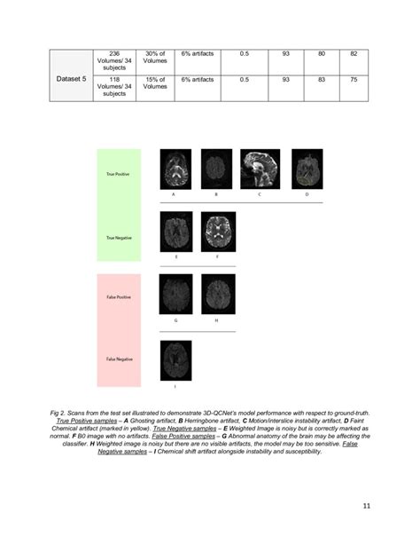 3d Qcnet A Pipeline For Automated Artifact Detection In Diffusion Mri Images Deepai