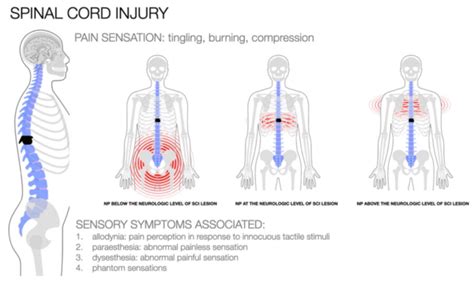 Spinal Cord Compression Nurses Revision