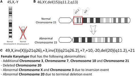 Deletion Genetics Wikipedia