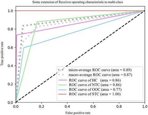 the roc plots of lgbm classification roc receiver operating