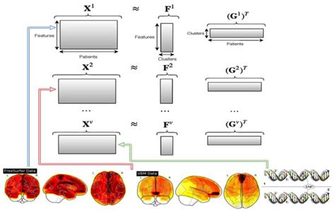 Adaptive Weighted Multiview Kernel Matrix Factorization And Its Application In Alzheimers
