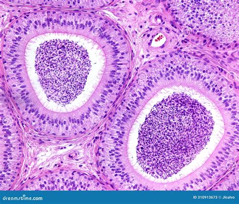 Epididymis Stock Image Image Of Epithelium Paraffin 310913673