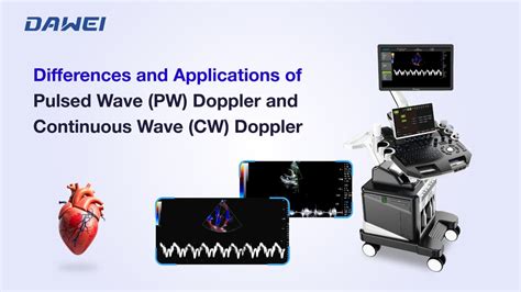 Differences And Applications Of Pulsed Wave Pw Doppler And Continuous