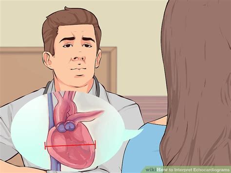How To Interpret Echocardiograms 8 Steps With Pictures