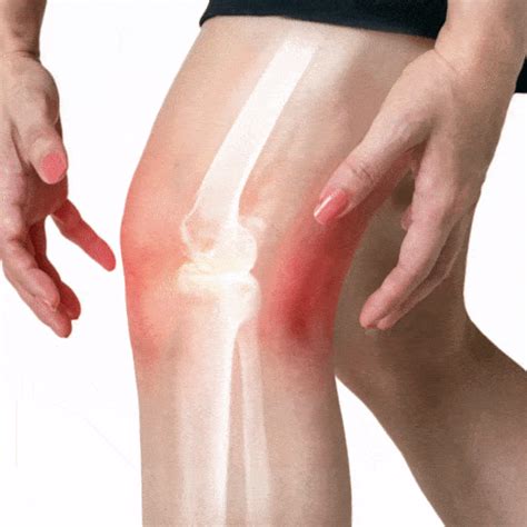 The Perfect Solution For Knee Injuries Fusion Recovery
