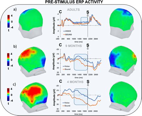 Prestimulus Erp Activity The Picture Shows The Electrophysiological Download Scientific