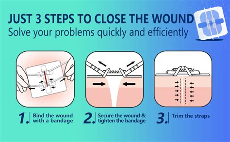 Arixmed Emergency Wound Closure Device Zip Sutures Butterfly Bandaids