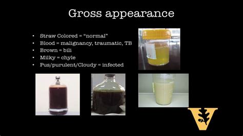 Paracentesis Fluid Interpreting Abdominal Fluid In Colic Horses