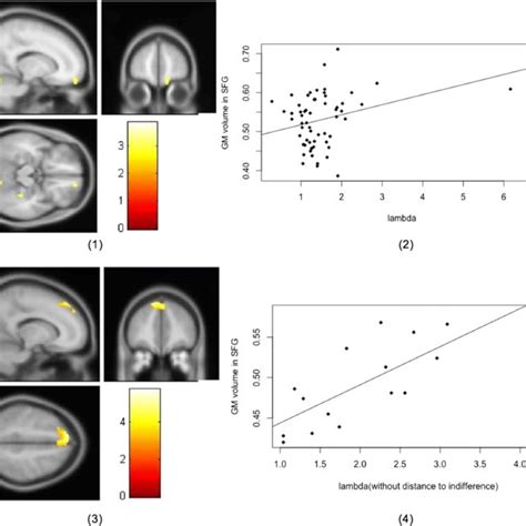 Left Multiple Regression Analysis Of Whole Brain Statistical Maps