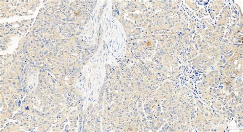 Vinculin Antibody 66305 2 Ig Proteintech