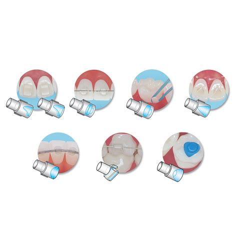 Mini Mold Tips Orthomax Australia