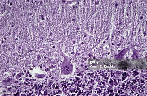 Purkinje Cell Cerebellum 100x At 35mm Shows Cell Body Nucleus Nucleolus