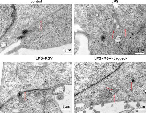 The Effect Of Notch1 Pathway Activation On The Tight Junction Structure