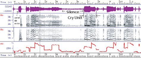Figure 2 From Evolutionary Neural System To Classify Infant Cry Units For Pathologies