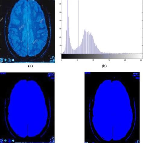 Segmentation Of Image 1 A Original Image B Histogram C Segmented