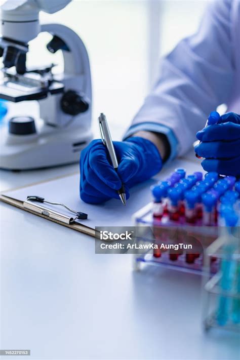 동맥혈 샘플을 검사하는 전문 의사 현미경으로 간호사의 전문 연구 실험실 사무실에서 여성 실험실 조교가 들고 있는 혈액 시험관 클로즈업 간호사에 대한 스톡 사진 및 기타