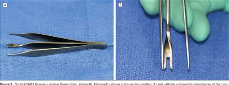 Figure 2 From Comparison Of Incision Closures With Subcuticular And