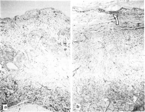 A Light Microscopic Cross Sectional View Showing The Typical Download Scientific Diagram