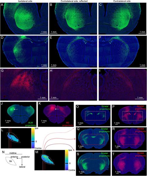 Symmetry In Frontal But Not Motor And Somatosensory Cortical