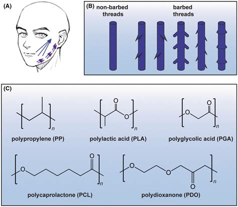 A Schematic Of Injection Patterns For The Clinical Use Of Barbed