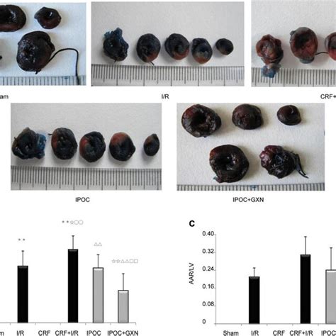 Myocardial Ischemia And Infarct Area A Myocardial Infarction Area Download Scientific