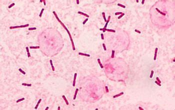 Salmonella Enterica Gram Stain